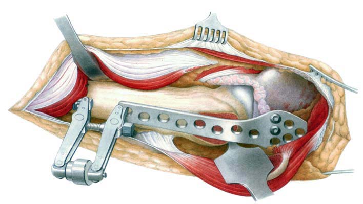 Stephan Spitzer Atelier für Medizinische Illustration
