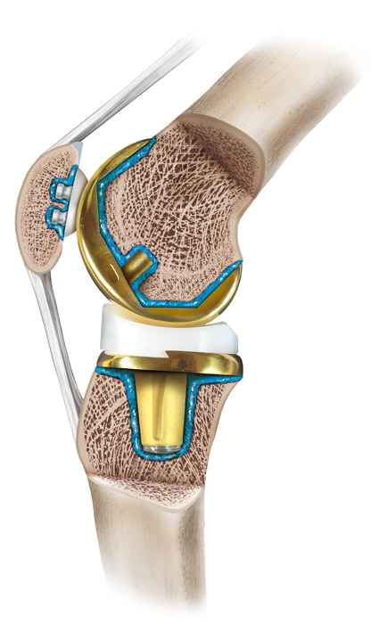 Stephan Spitzer Atelier für Medizinische Illustration