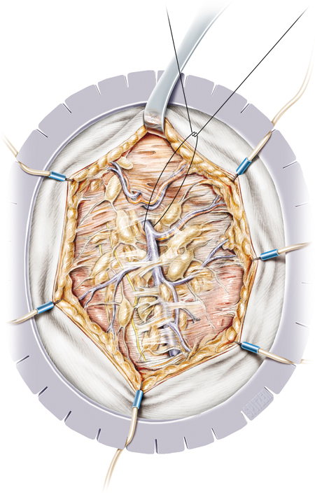 Stephan Spitzer Atelier für Medizinische Illustration