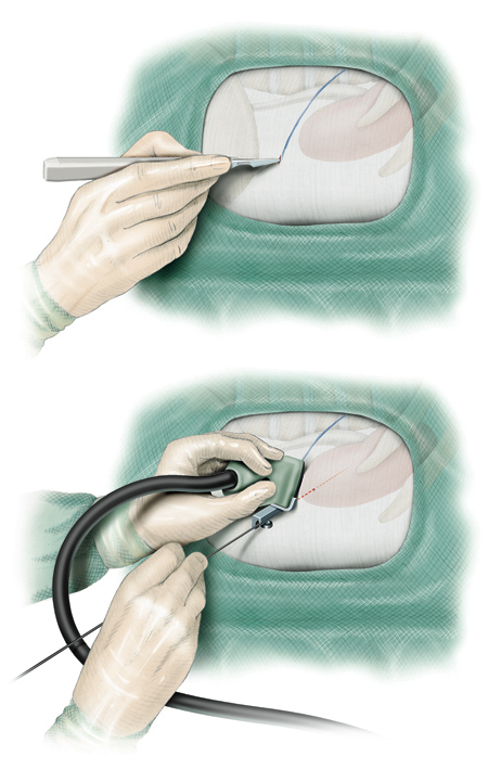 Stephan Spitzer Atelier für Medizinische Illustration