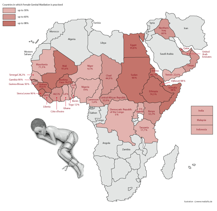 Stephan Spitzer Atelier für Medizinische Illustration